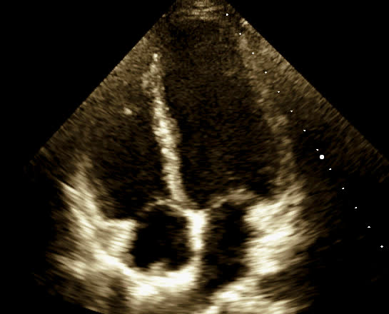 A4C Classification Dataset by A4C