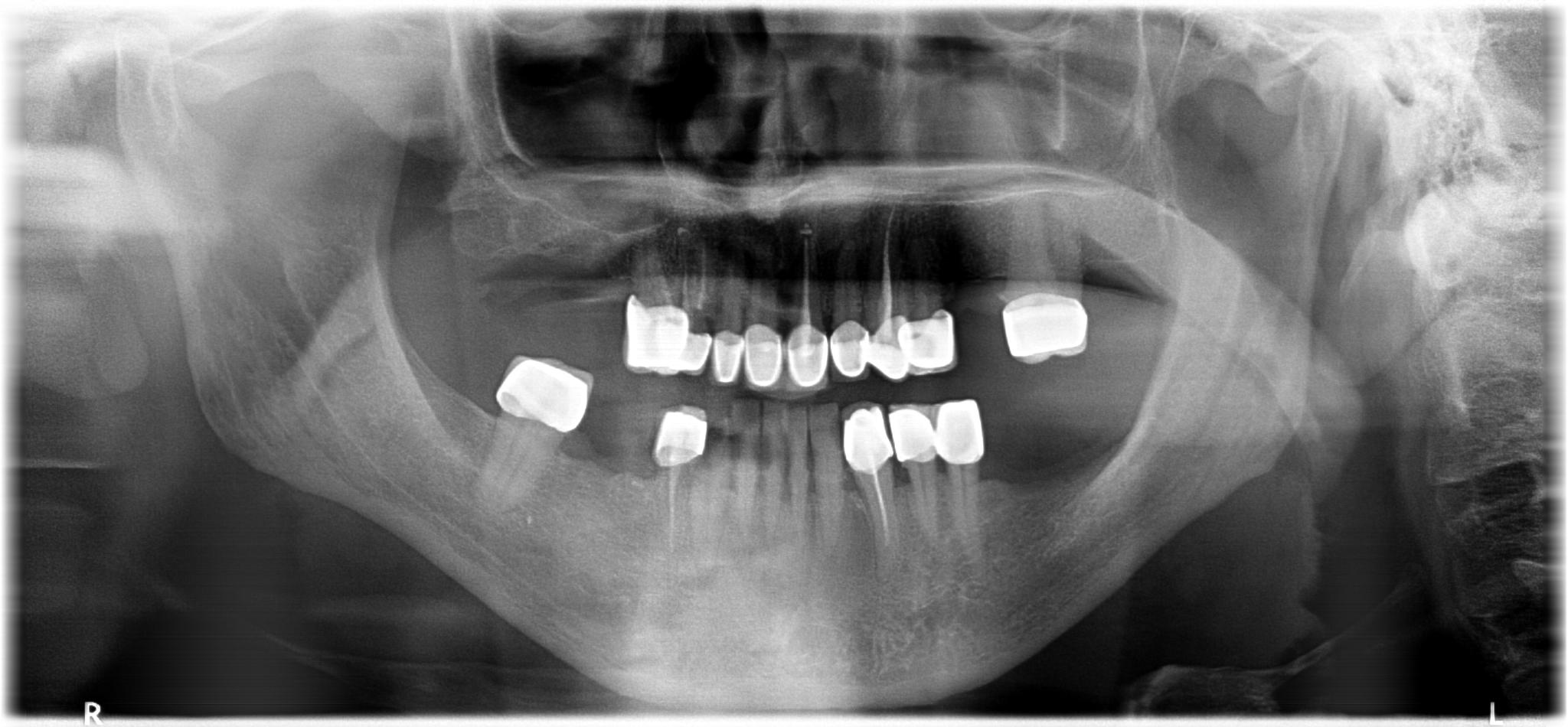 valid_aug Object Detection Dataset by Nithin