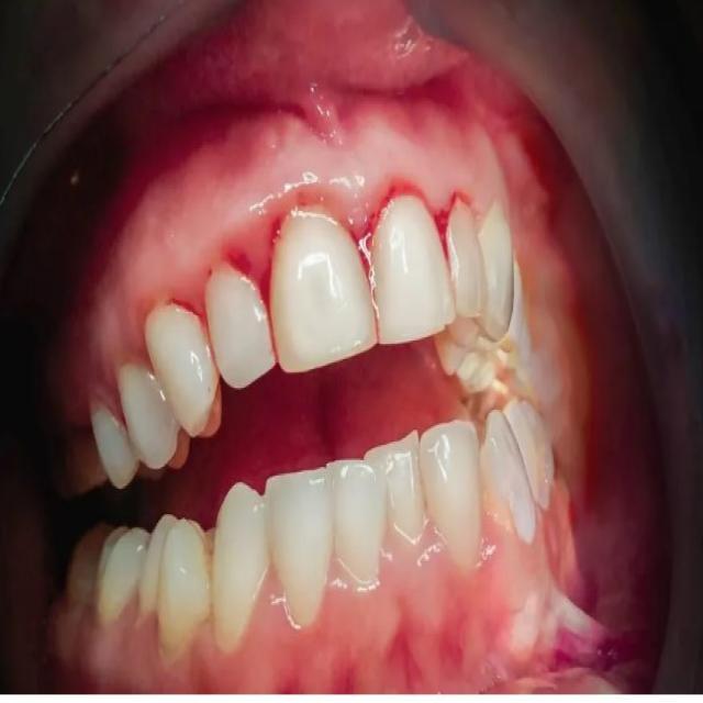 Object Detection Object Detection Dataset By Abdul Aziz