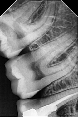tooth Xray second Worke Keypoint Detection Dataset by Abdul Aziz