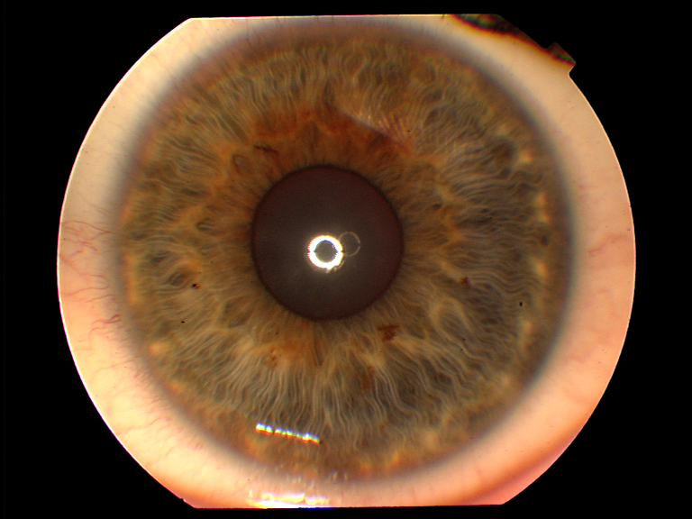 Segmentation Rgb Irisimagedataset Semantic Segmentation Dataset By Pfe Crns