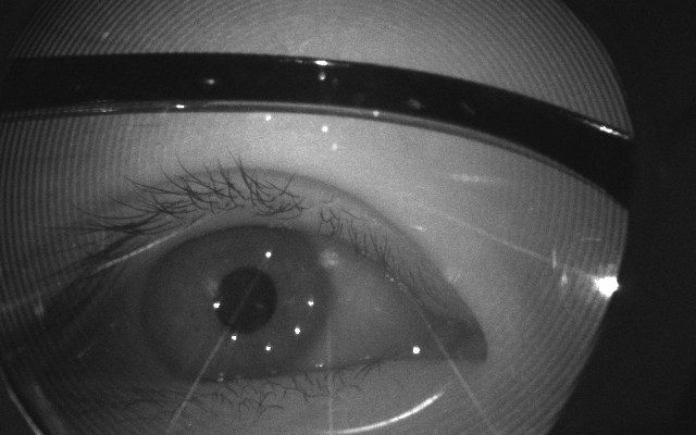 Openeds Object Detection Dataset By Pfe Crns