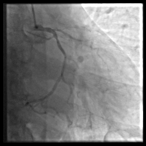 segmentation Instance Segmentation Model by Memoire
