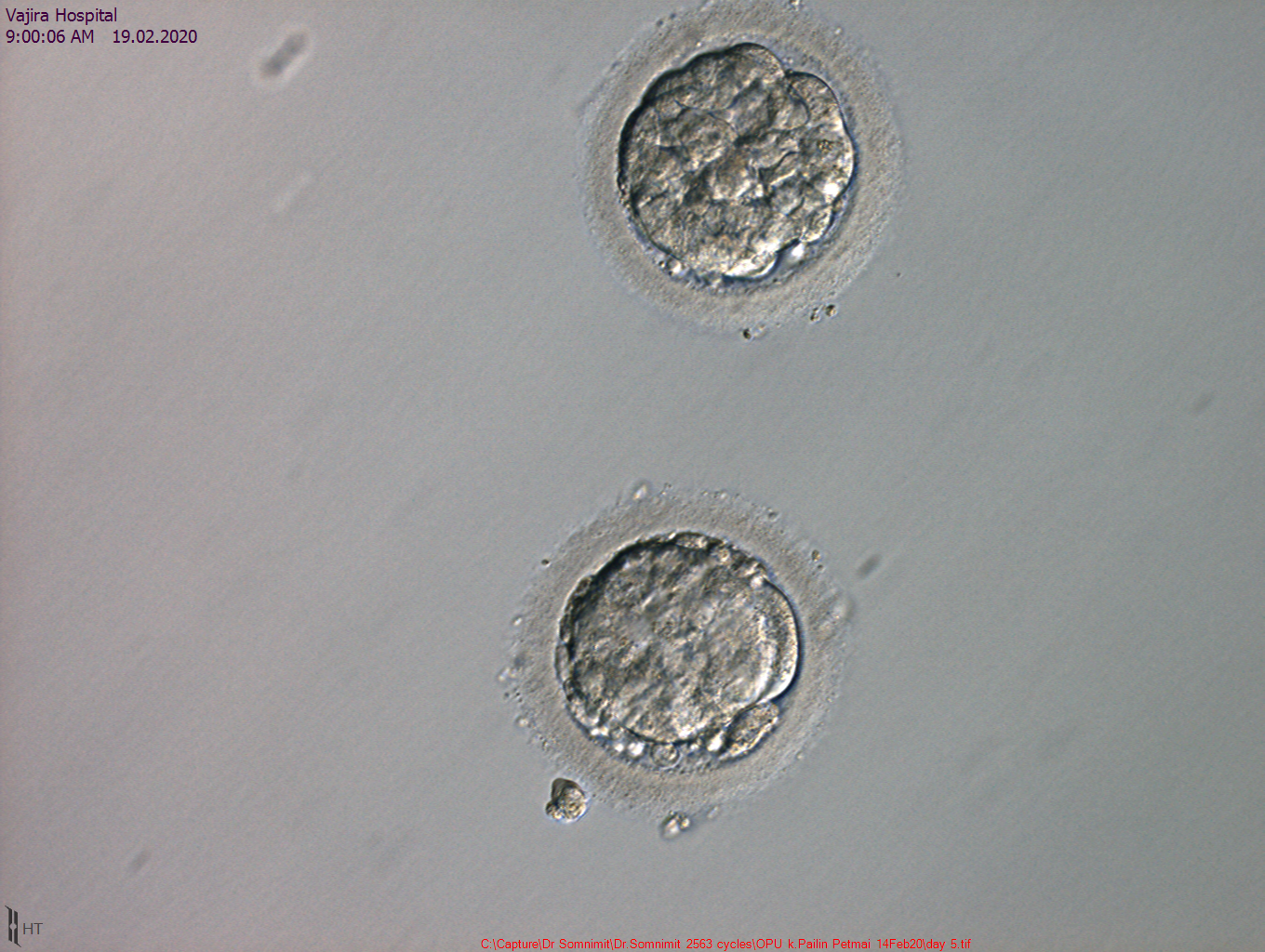 embryo-detection Object Detection Model by embryo