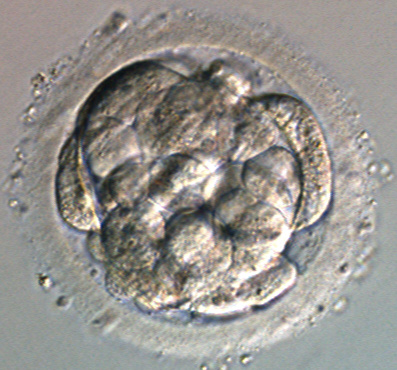embryo-classification Classification Model by embryo