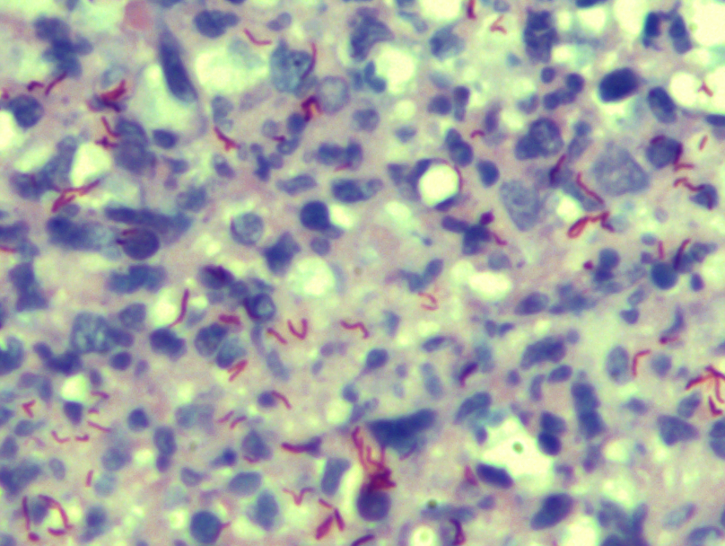 Tuberculosis 2 Object Detection Dataset (v5, 2024-01-05 7:48am) by ... Tuberculosis 2 Object Detection Dataset (v5, 2024-01-05 7:48am) by ...