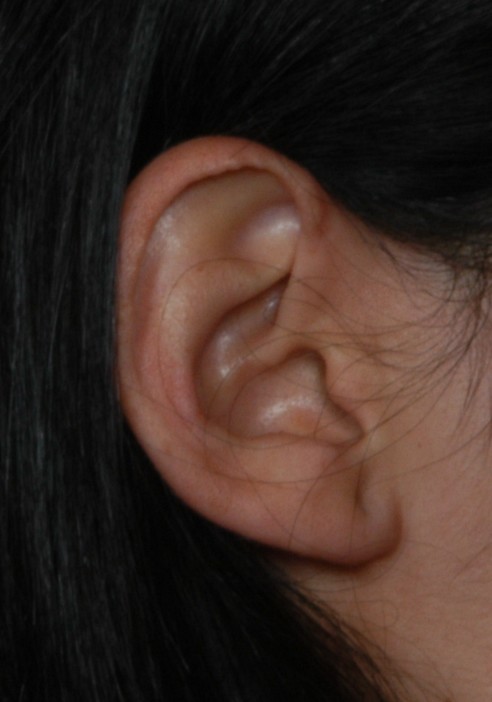 ENT Object Detection Dataset by NEETHIDEVAN V