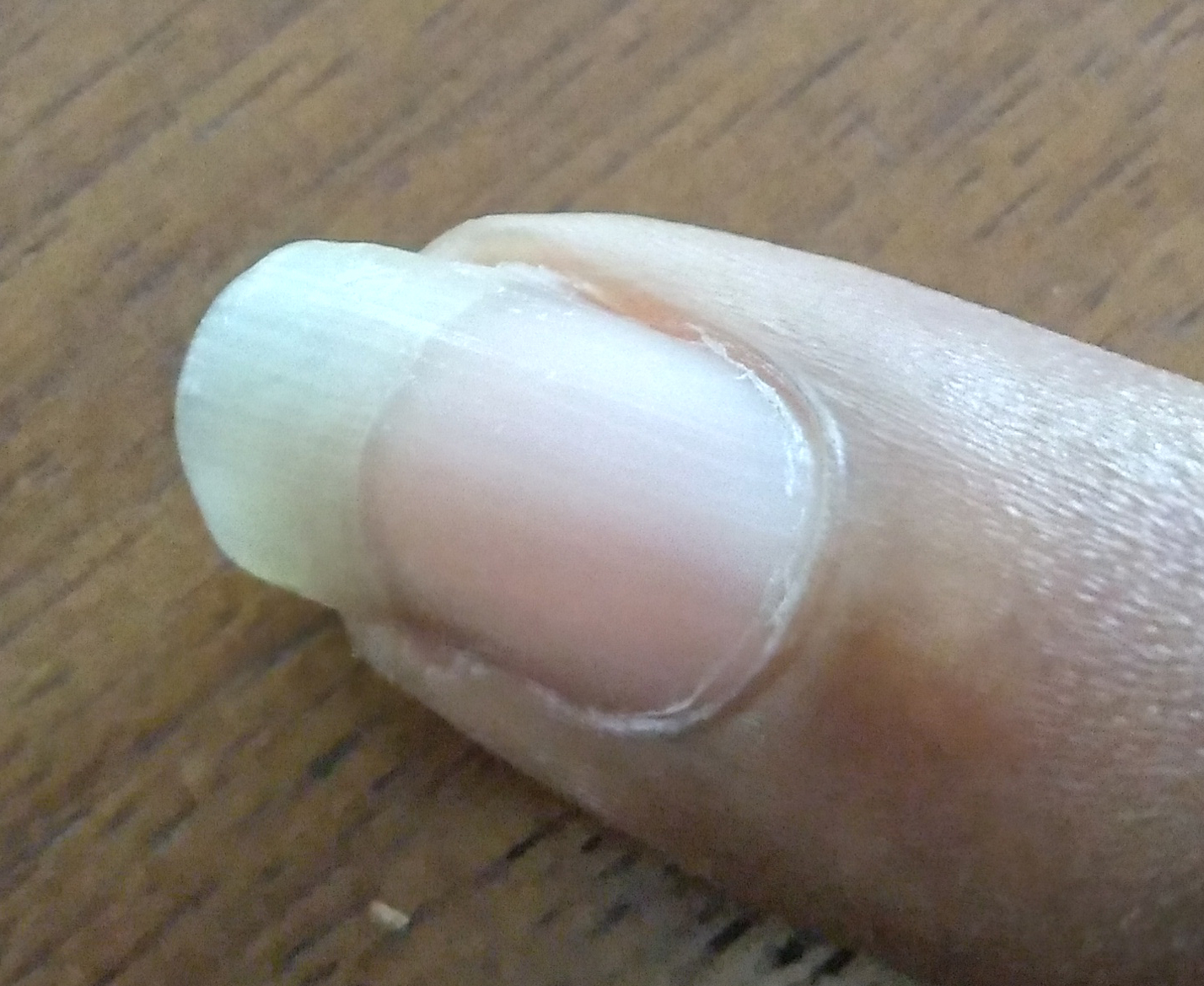 nail Classification Model by nail