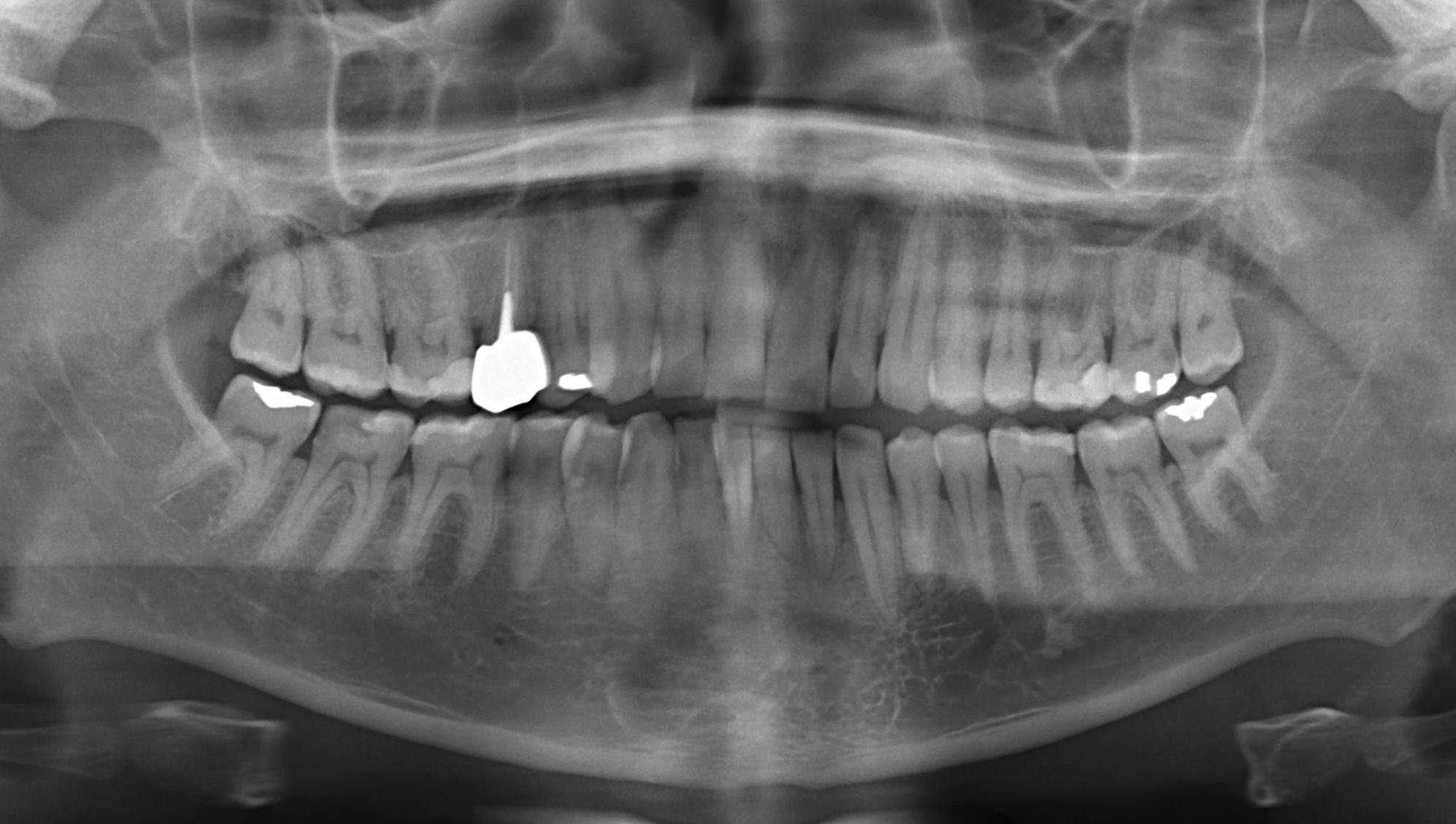 medical teeth Instance Segmentation Dataset by humza