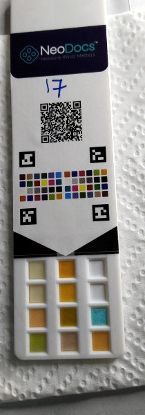 Neodocs Urine Card - Roboflow Universe