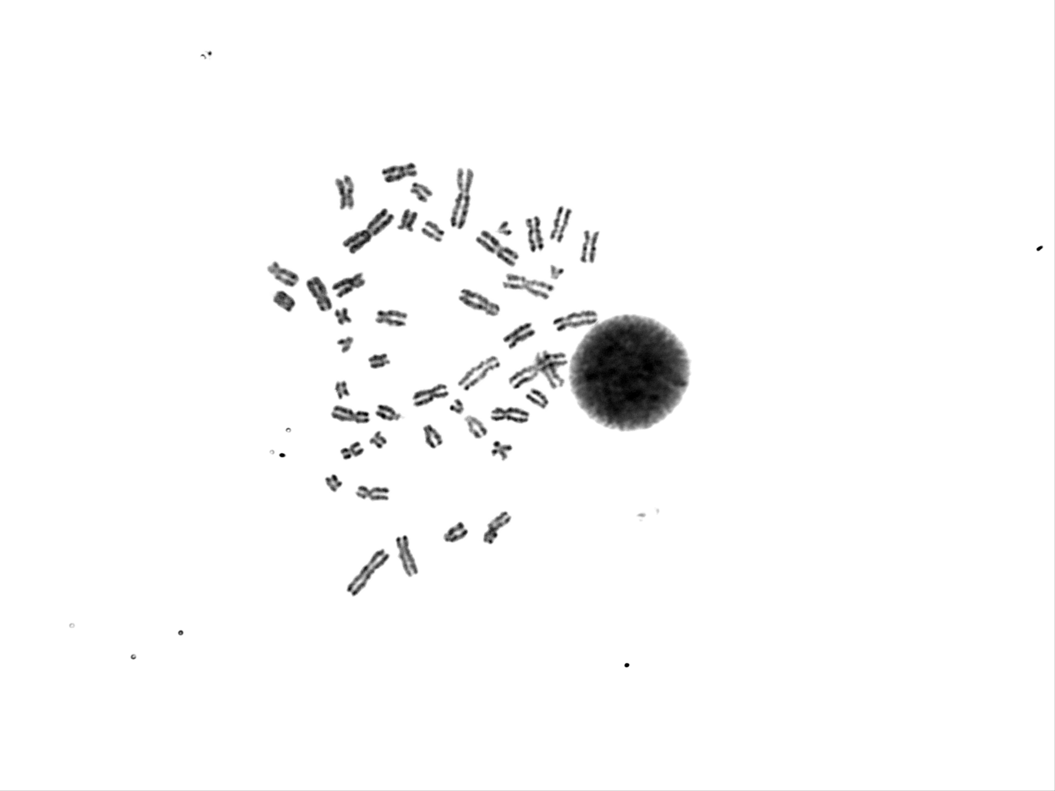 EXTRACTION CHROMOSOMES - Roboflow Universe