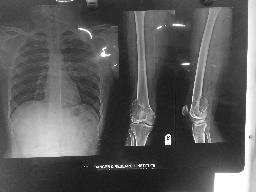 train knee Instance Segmentation Dataset by My Workspace