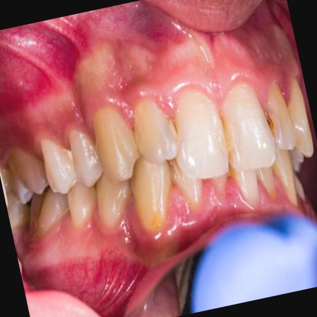 oral-batch1 Object Detection Dataset by oralaibatch1