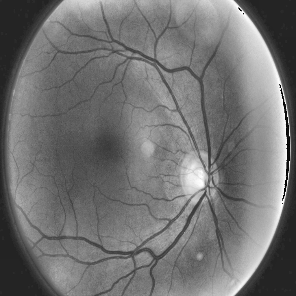 DR Classification Dataset and Pre-Trained Model by UCSI