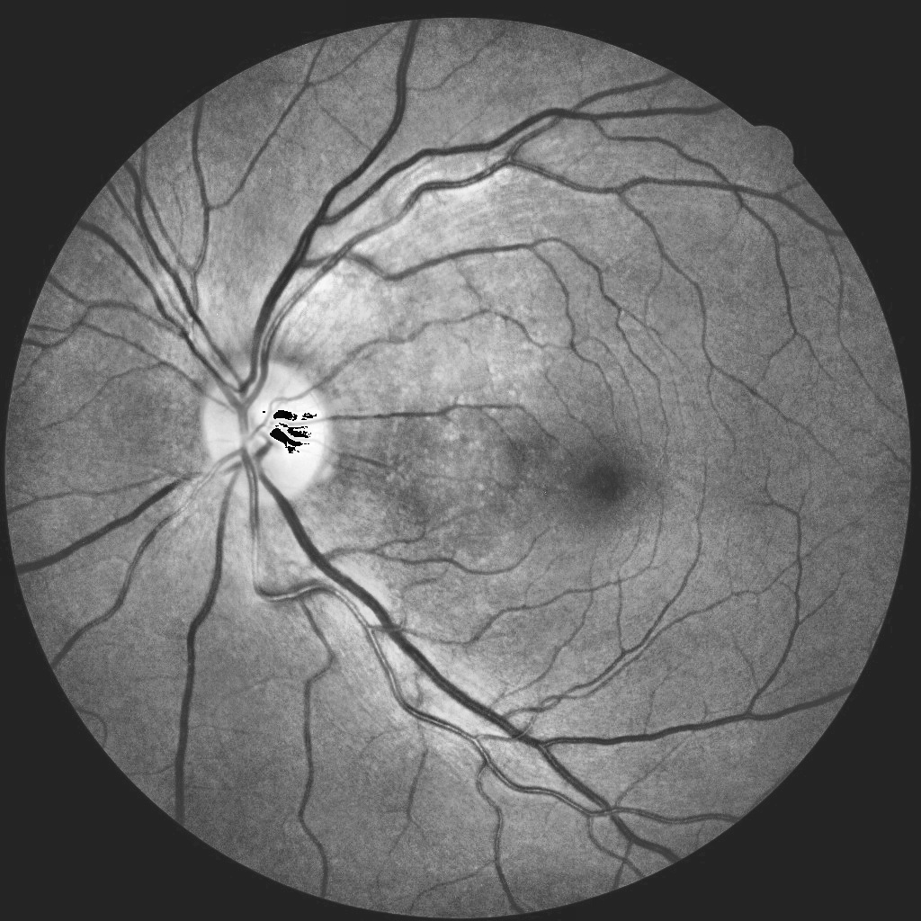 DR Classification Dataset by UCSI