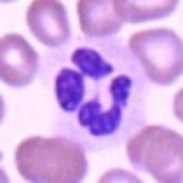 Cell Classification Classification Dataset by PBS WBC