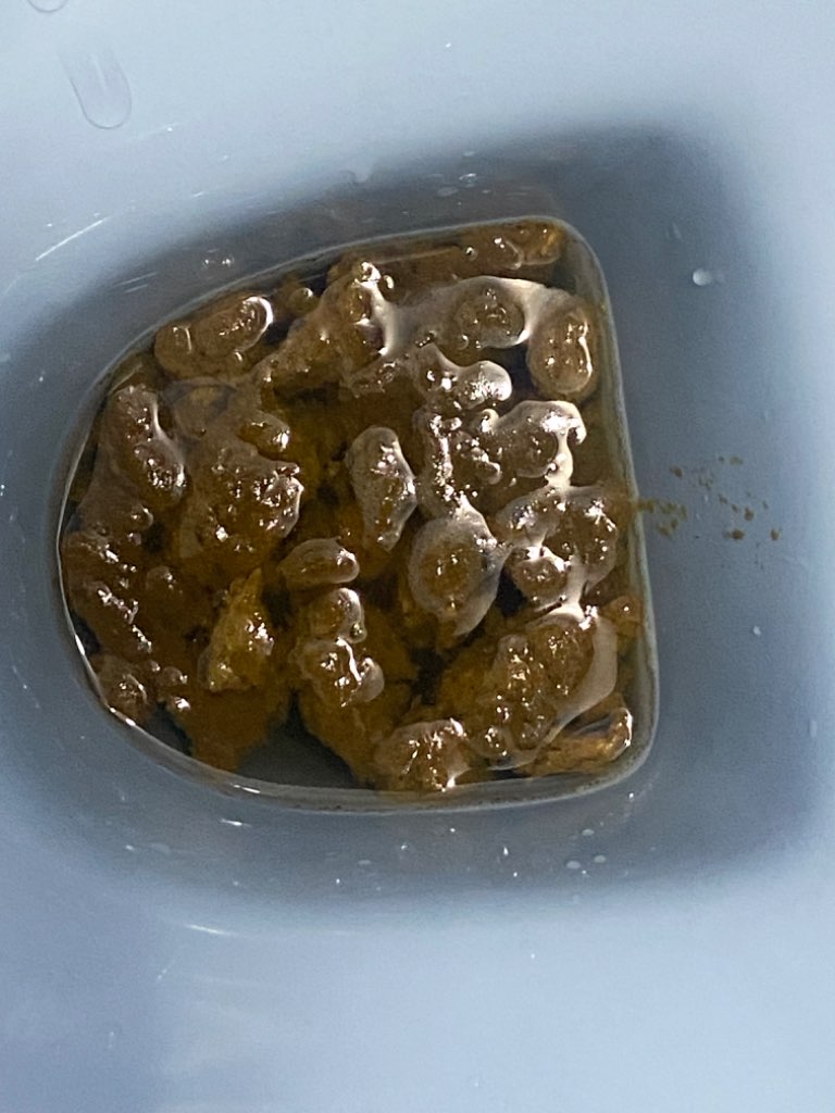 poop2 Semantic Segmentation Dataset by Han