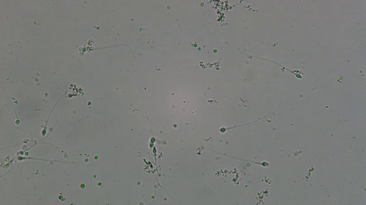 Sperm detection (full) Object Detection Dataset and Pre-Trained Model by Sperm analysis