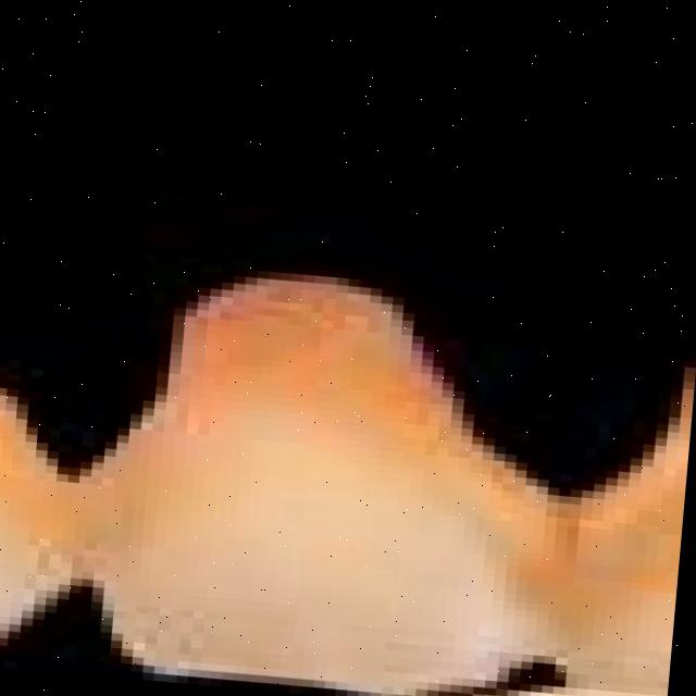 Ver10 02 Caries Detection Object Detection Dataset By Hlmnbr