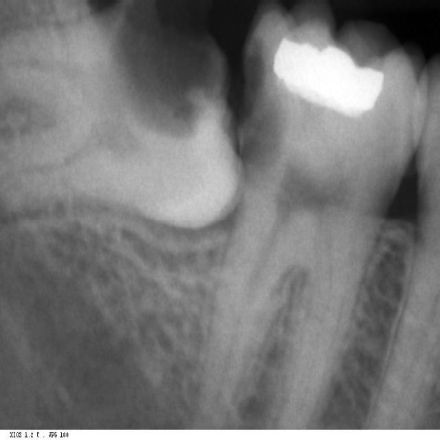 Done1notdataset Object Detection Dataset And Pre Trained Model By Jesse Perring