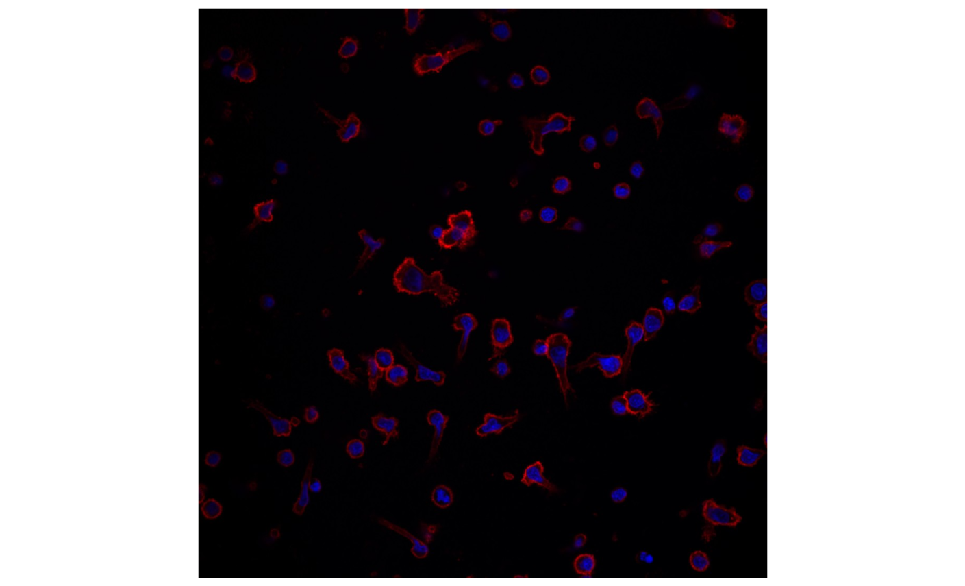 T-CELL CLASSIFICATION Object Detection Dataset and Pre-Trained Model by Bitirme
