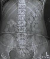 How to Use the X-ray baggage detection Object Detection API