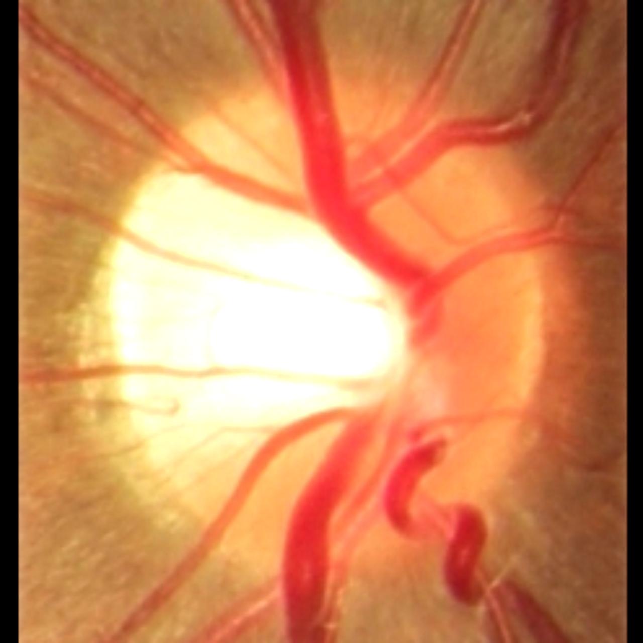 Refuge_D1 Object Detection Dataset by project1