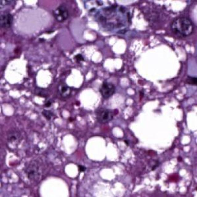 2 Object Detection Model by liver