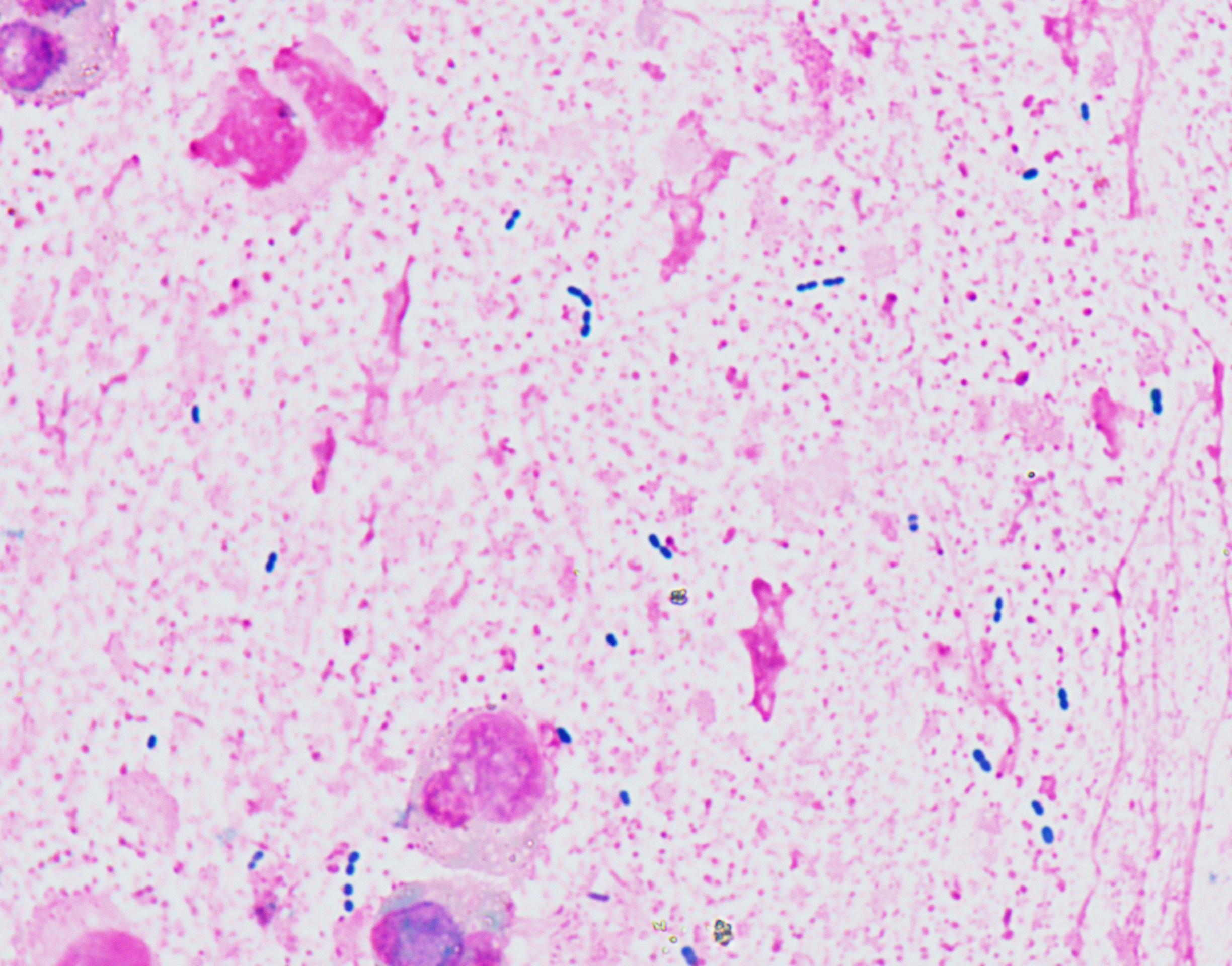 bacteria Object Detection Dataset and Pre-Trained Model by Roboflow 100 bacteria Object Detection Dataset and Pre-Trained Model by Roboflow 100