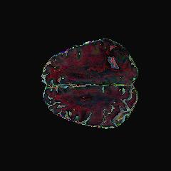 brain tumor Object Detection Model by Roboflow 100