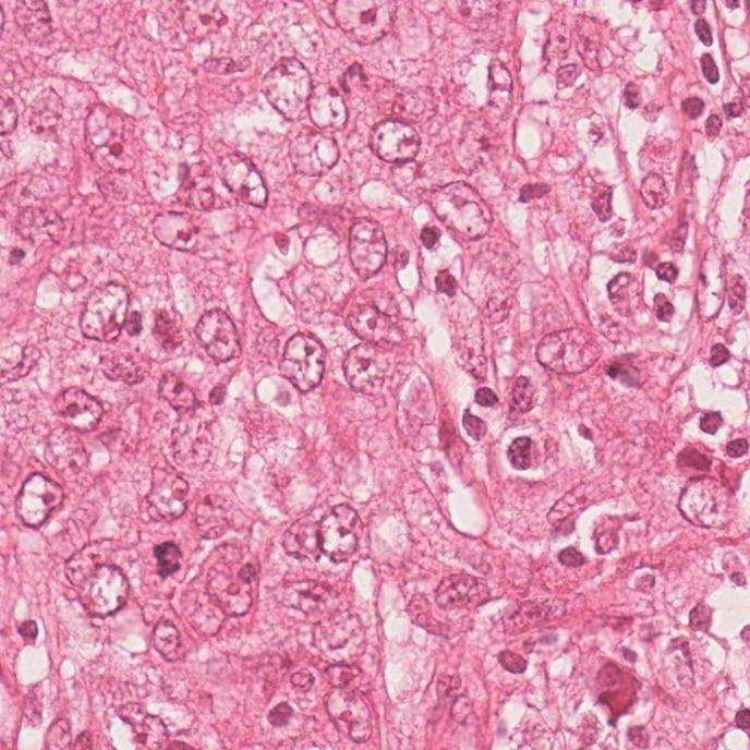 Mitosis Object Detection Dataset And Pre Trained Model By Roboflow 100