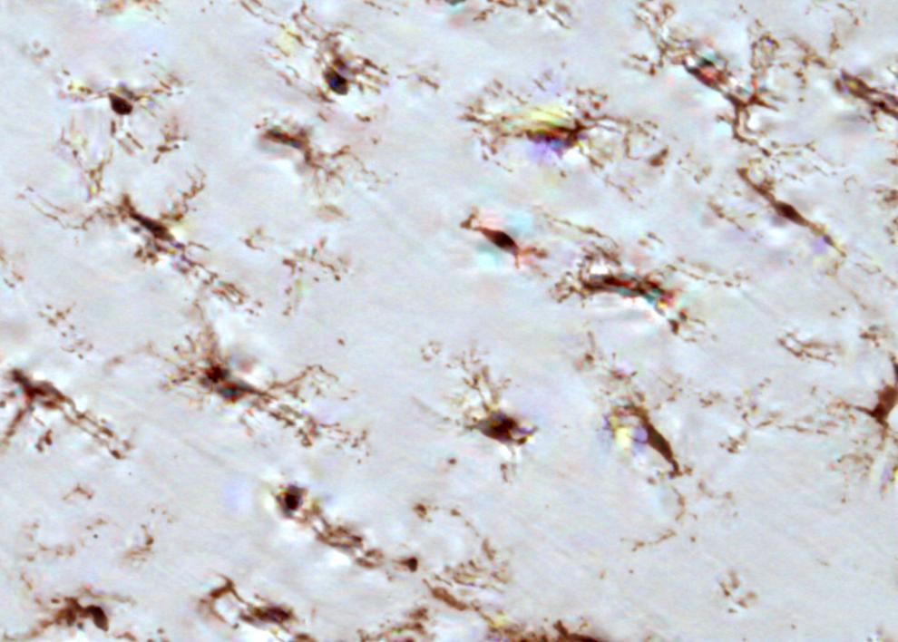 phages Object Detection Dataset and Pre-Trained Model by Roboflow 100 phages Object Detection Dataset and Pre-Trained Model by Roboflow 100