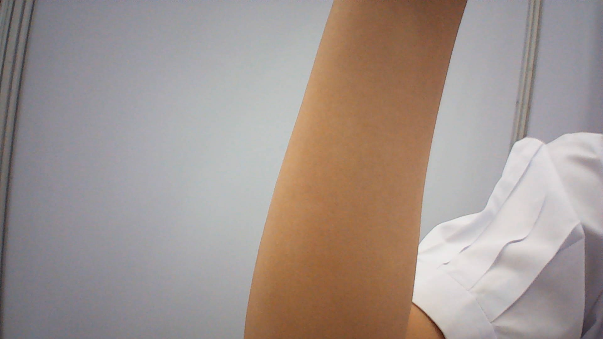 skin Classification Model (v2, 2026-02-01 1:45pm) by Putter