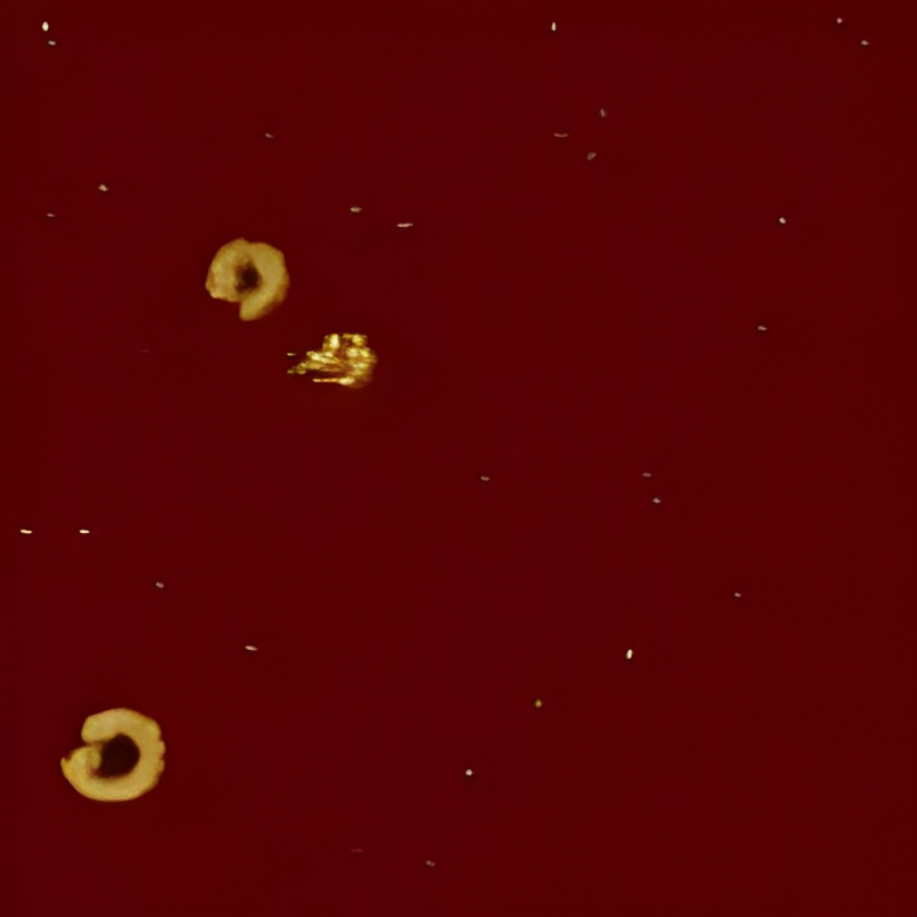 protein shape - Roboflow Universe