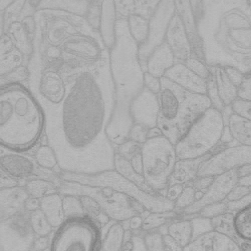 Flattening Segmentation Instance Segmentation Dataset by CV Project