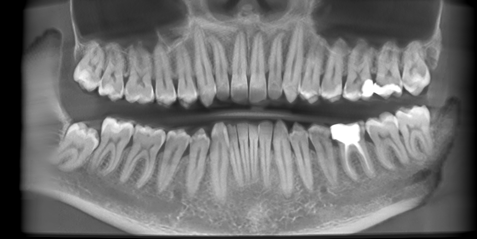 rentgen teeth Instance Segmentation Model by Gleb Bondarchuk