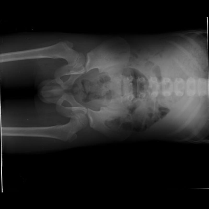 yolo_fracture_detection Object Detection Dataset by CVPR