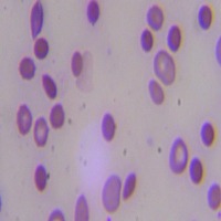 annotation des images - Roboflow Universe