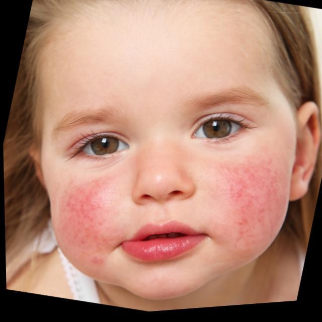 Skin Detection Object Detection Dataset by AshwinRocks