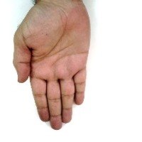 handpose Keypoint Detection Dataset by Lamar university