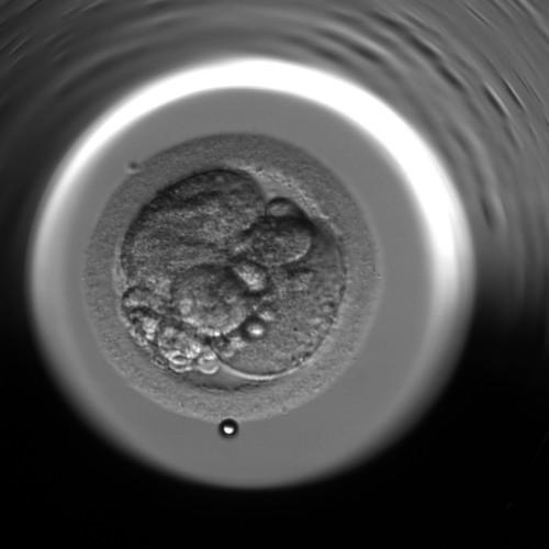 oocyte_new Object Detection Dataset and Pre-Trained Model by Oocyte3