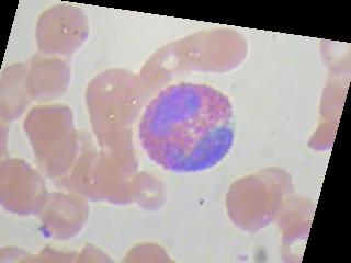 Eosinophil Object Detection Dataset and Pre-Trained Model by ...