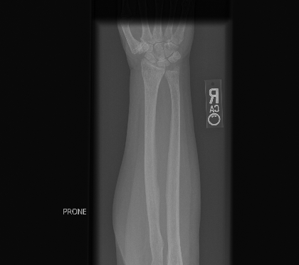 Bone_Joints_Detection_Main Object Detection Dataset by BoneResearch