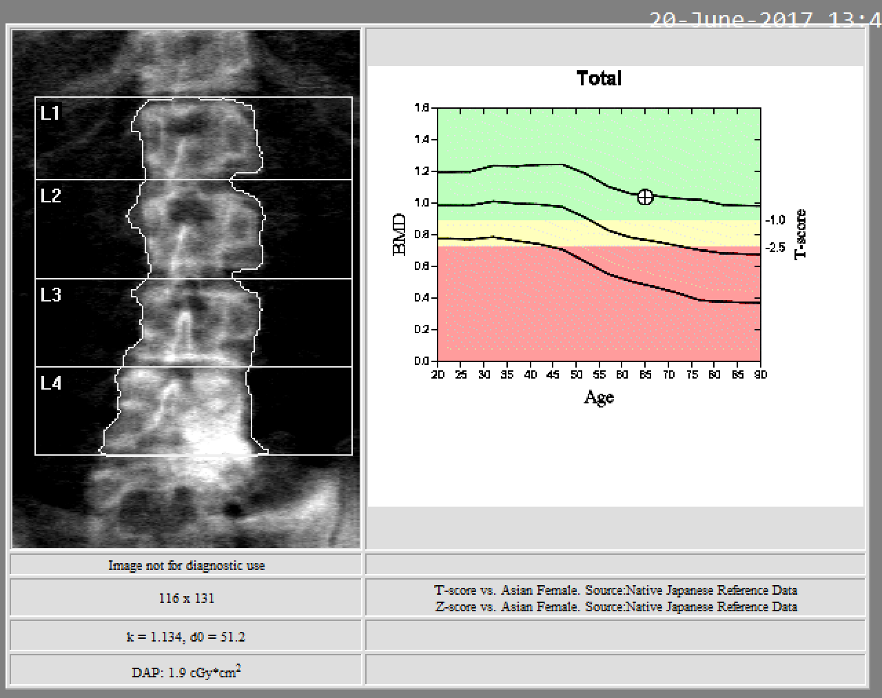 BMD result Object Detection Model by Modzie work