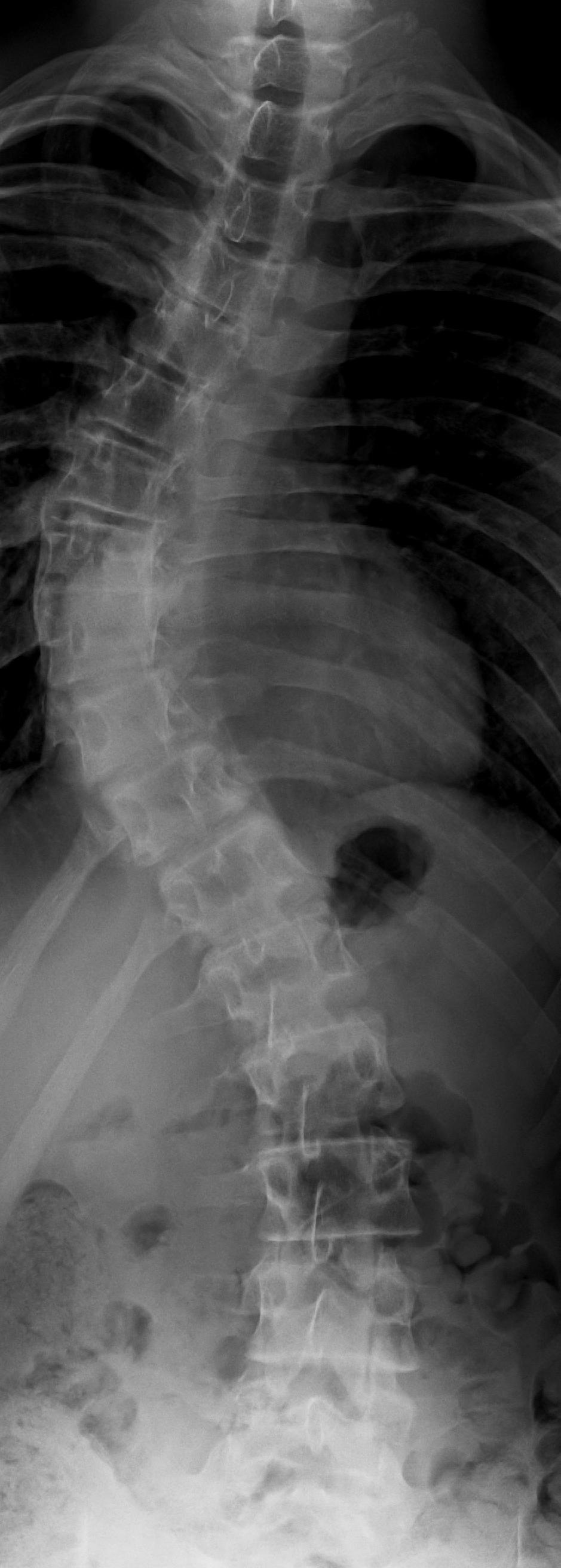 vert_labled_is Instance Segmentation Model by Spine