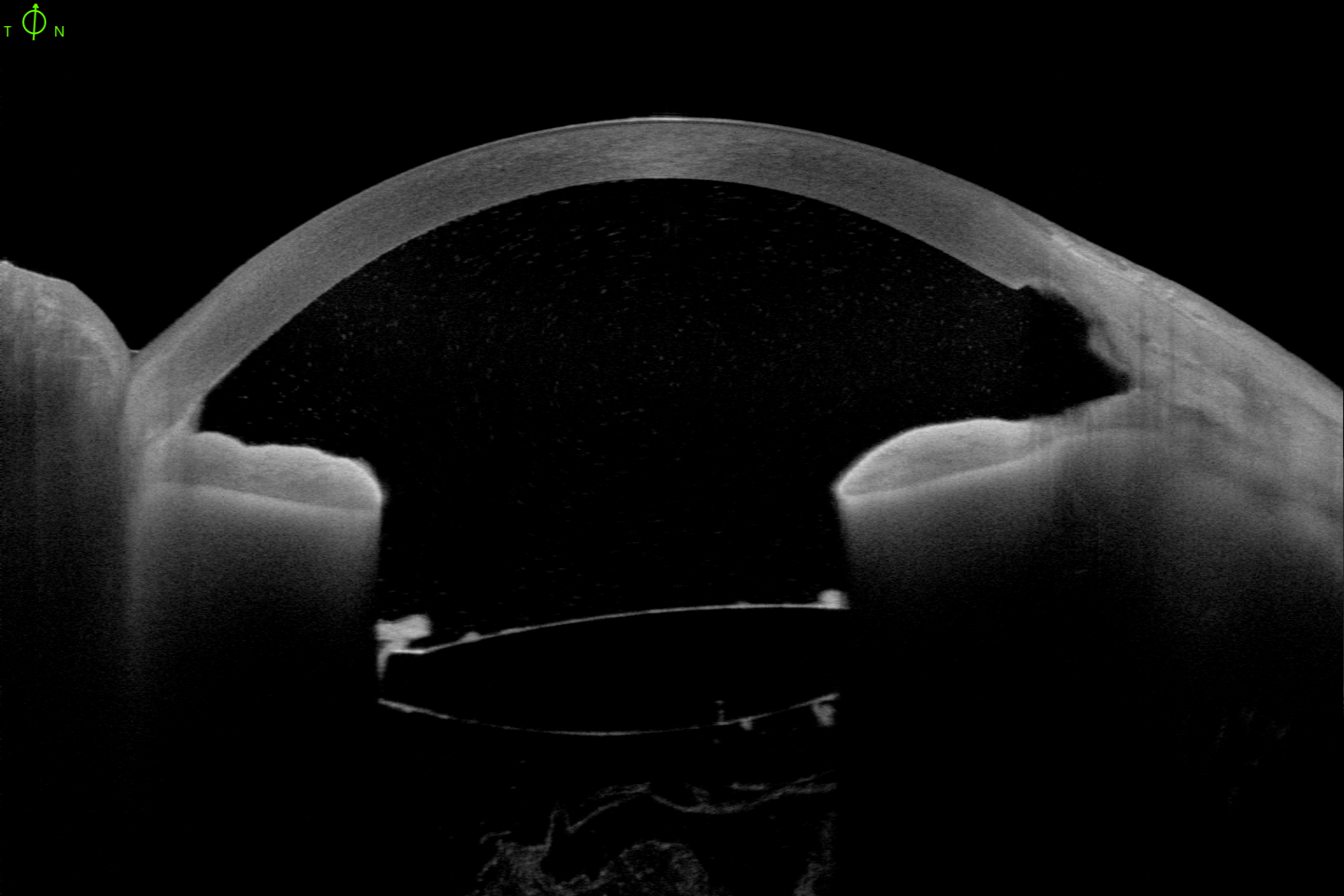 KP Object Detection Dataset by KP free