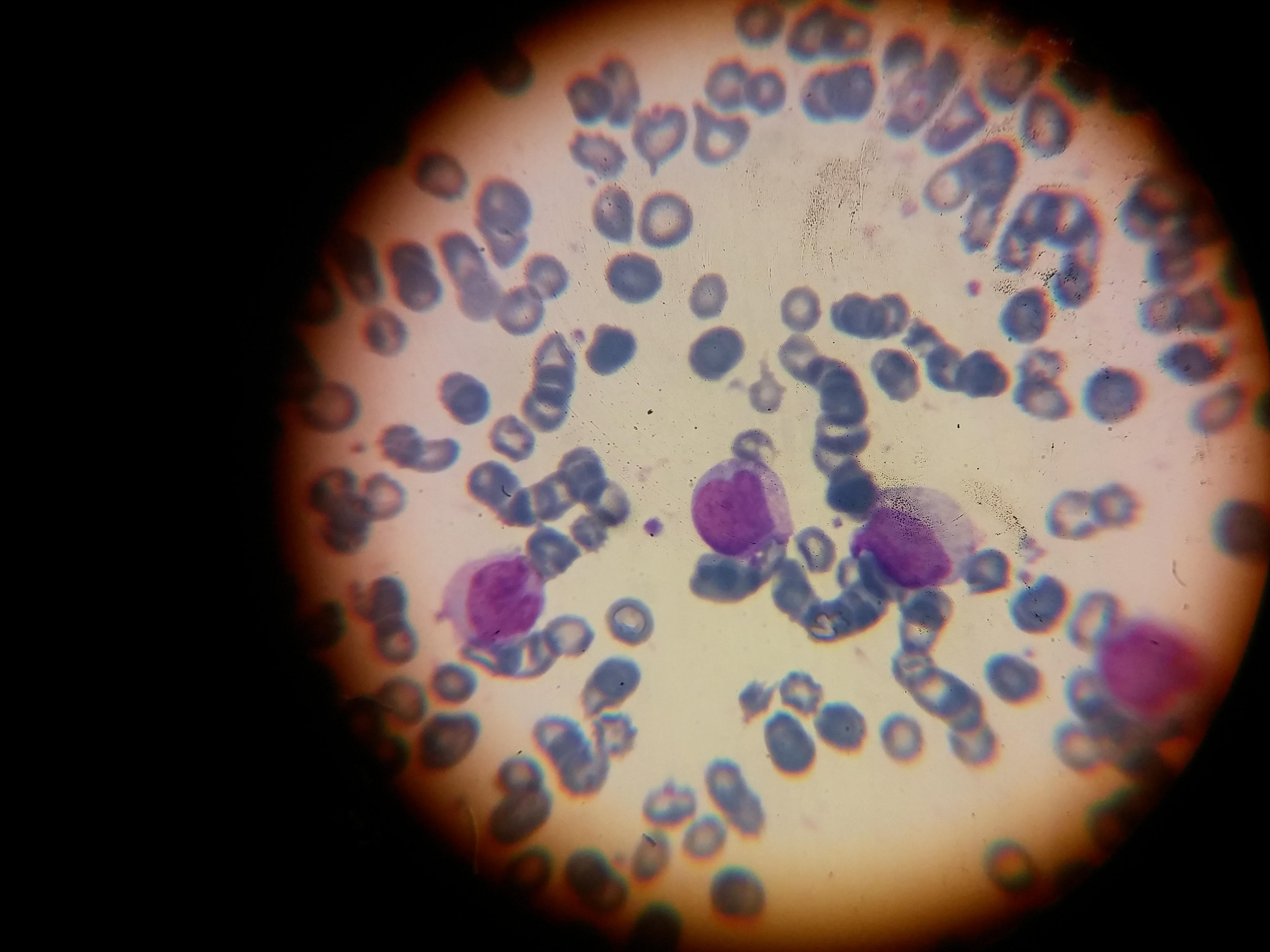 How to Use the Blood Smears Classification API