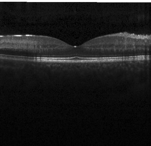 Project 1 Object Detection Model By Project