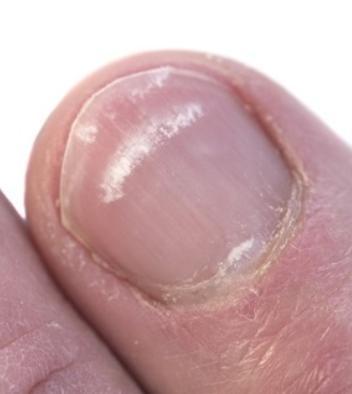 nail_segmentation Object Detection Dataset and Pre-Trained Model by conjuctiva