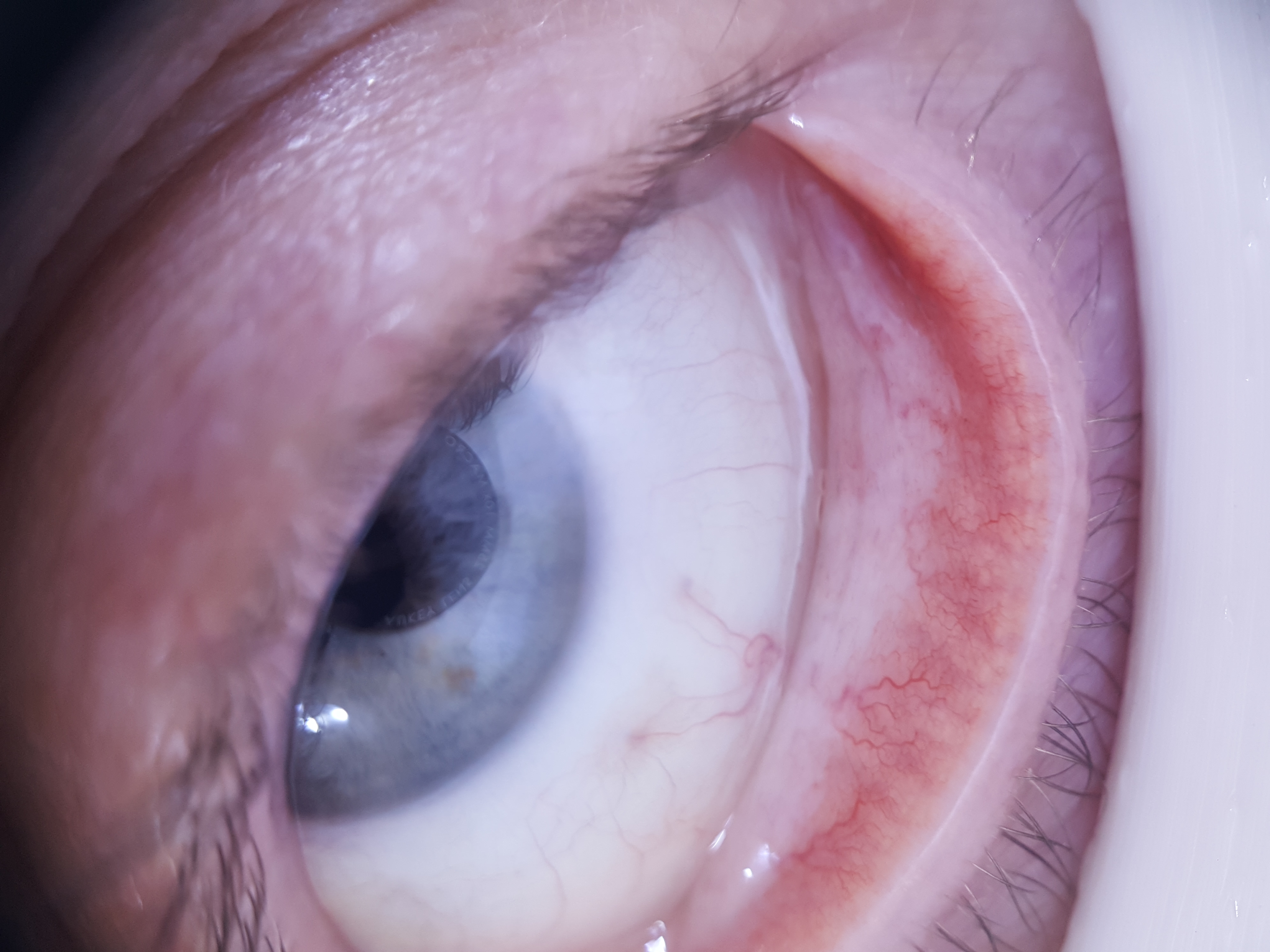 conjuctiva_detection Object Detection Model by conjuctiva